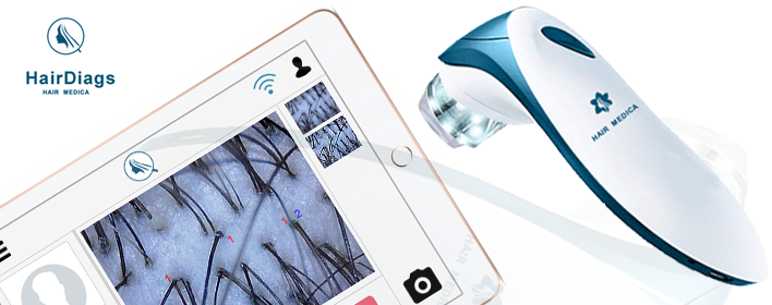 Kamera trychologiczna z programem do analizy. HairDiags - Hair Medica ...